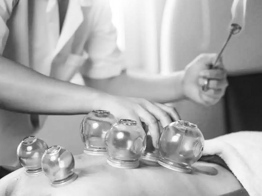 Tuina & Ventouses - Forma Structure, formations pour Ostéopathe D.O.